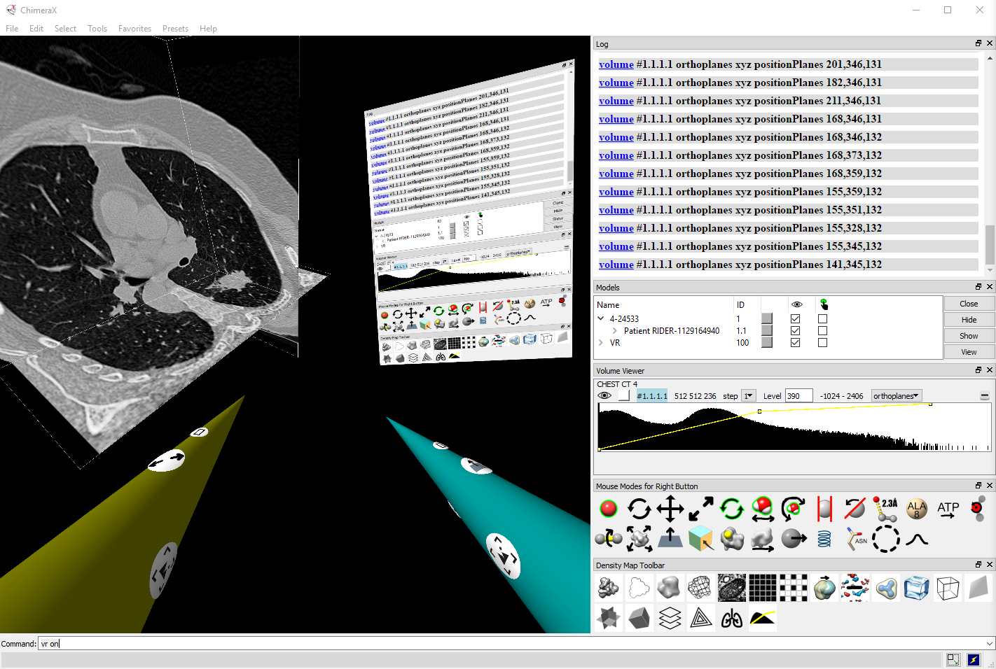 ChimeraX Tutorial: DICOM in Virtual Reality